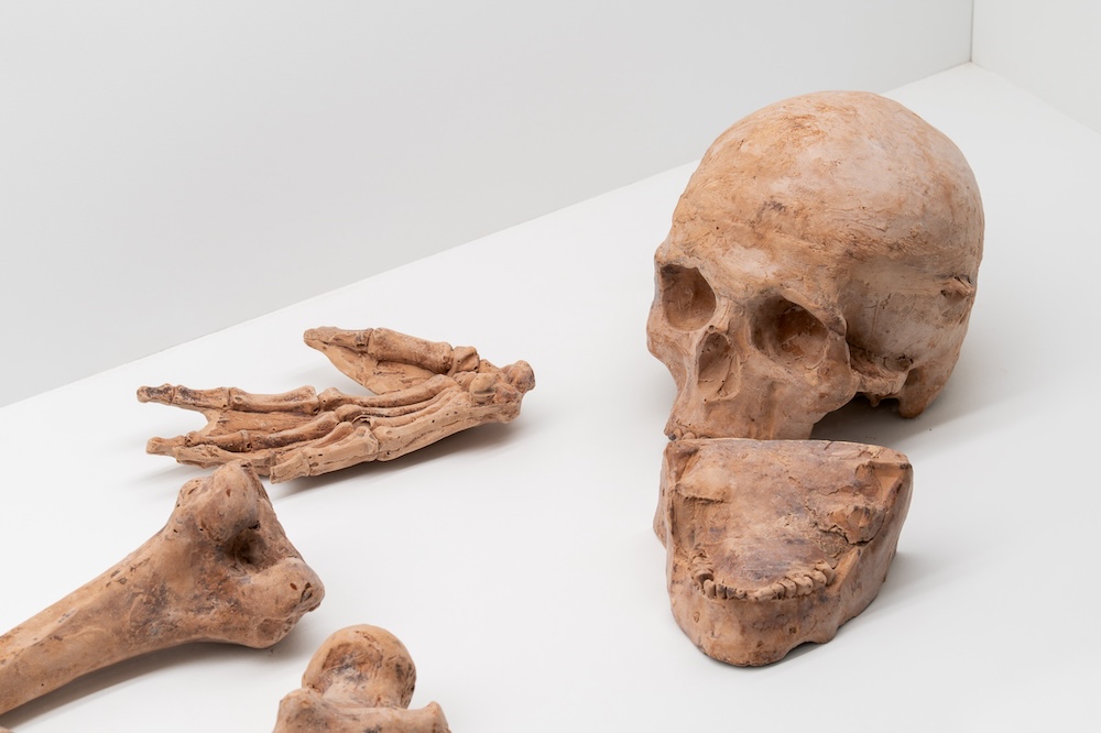 Body Believing: Jana Sterbak at Musée des Hospitalières and Esker ...